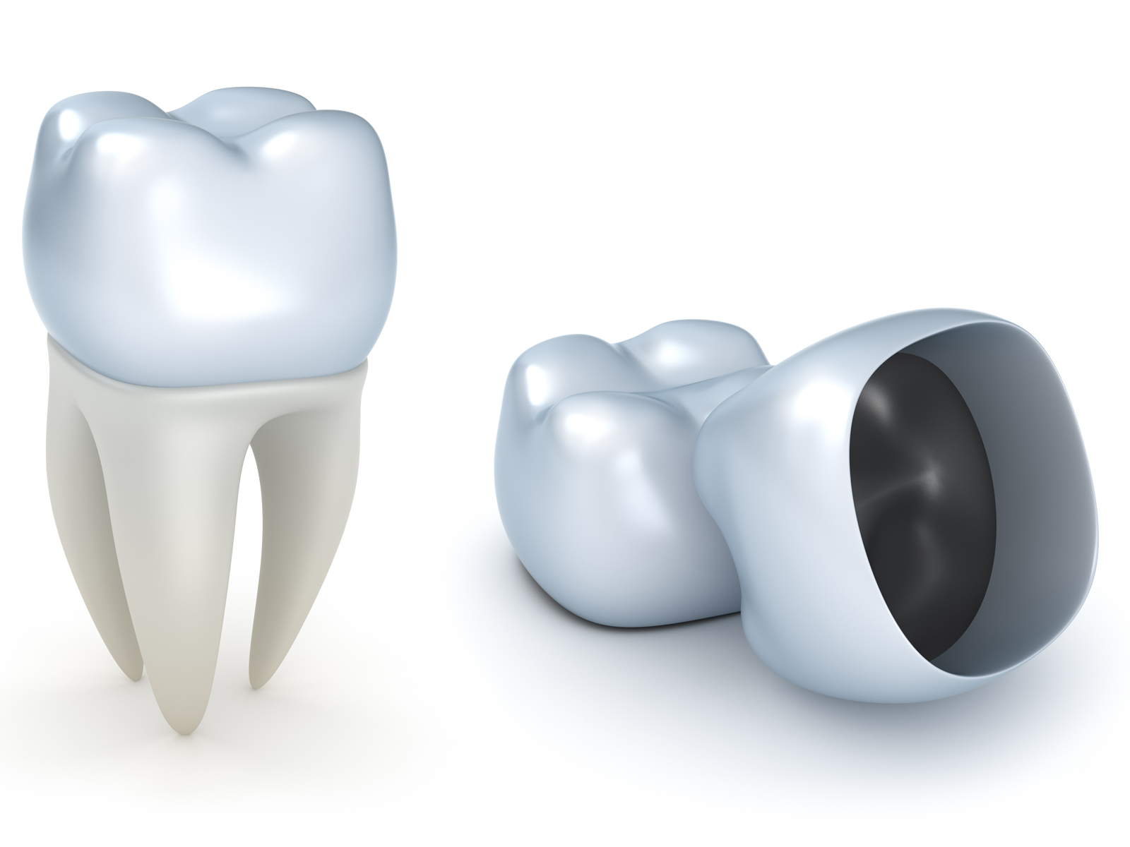 What is Gum Contouring or Crown Lengthening?